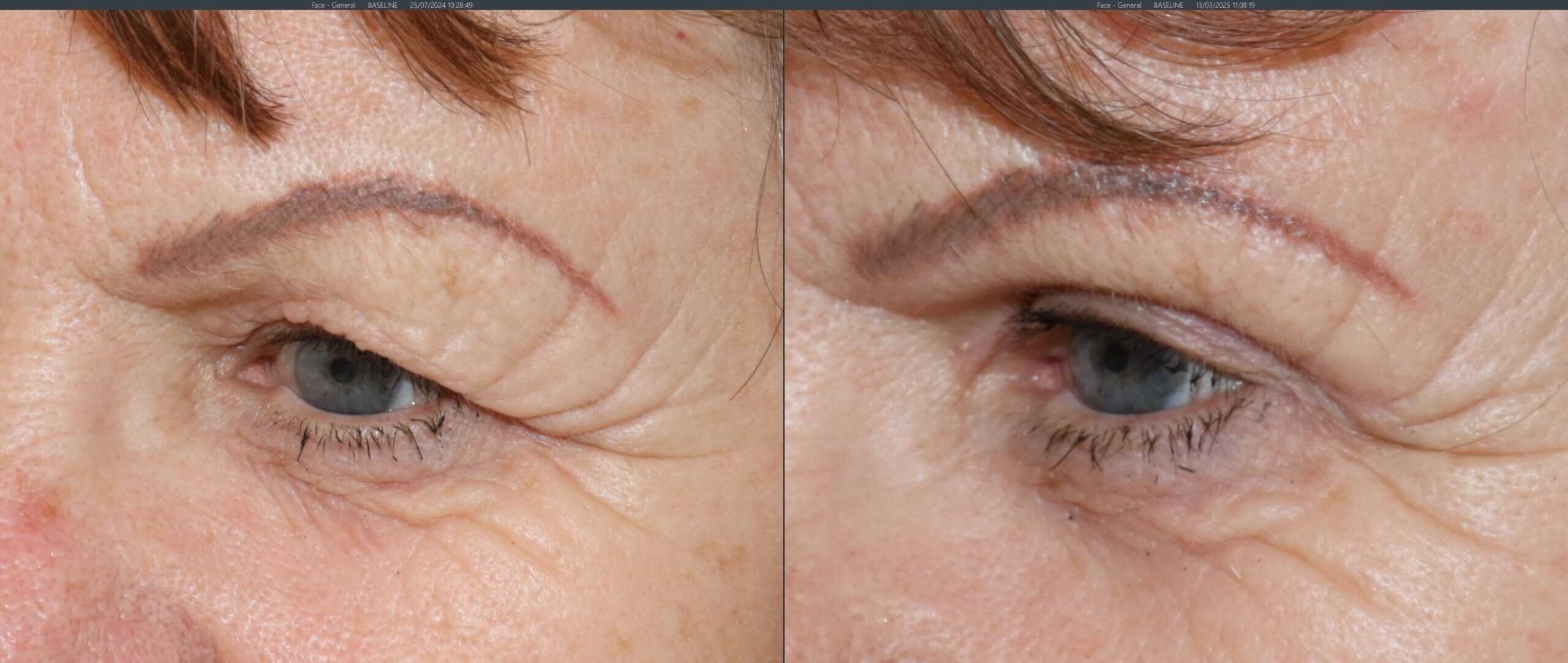 Infrared Sauna Therapy in Dundee | Detox & Rejuvenate