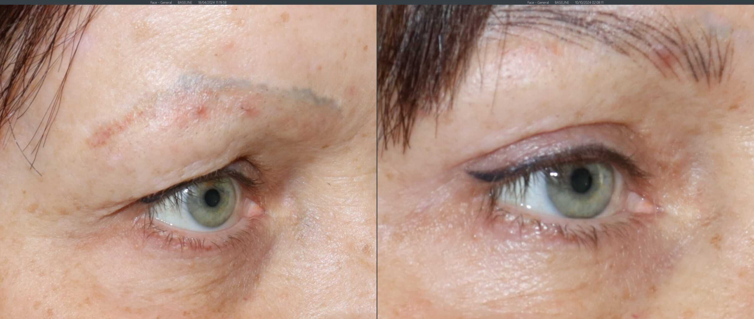 Infrared Sauna Therapy in Dundee | Detox & Rejuvenate