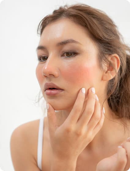 Sensitive & Redness-Prone Skin Care in Dundee | Gentle & Effective ...